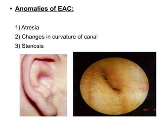 Anatomy & embryology ext ear & middle ear | ODP