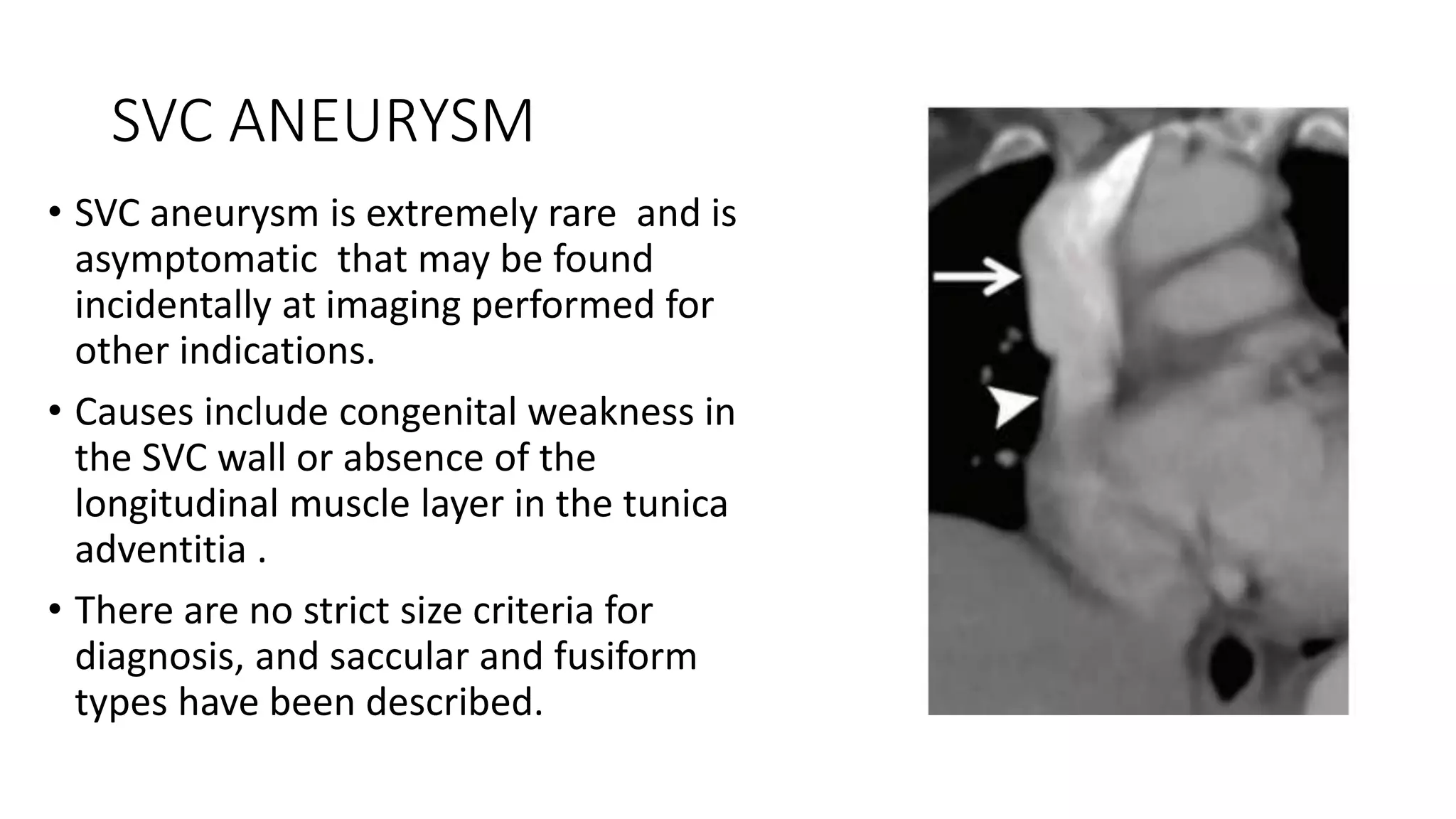 ANATOMY EMBRYOLOGY AND IMAGING OF SVC.pptx