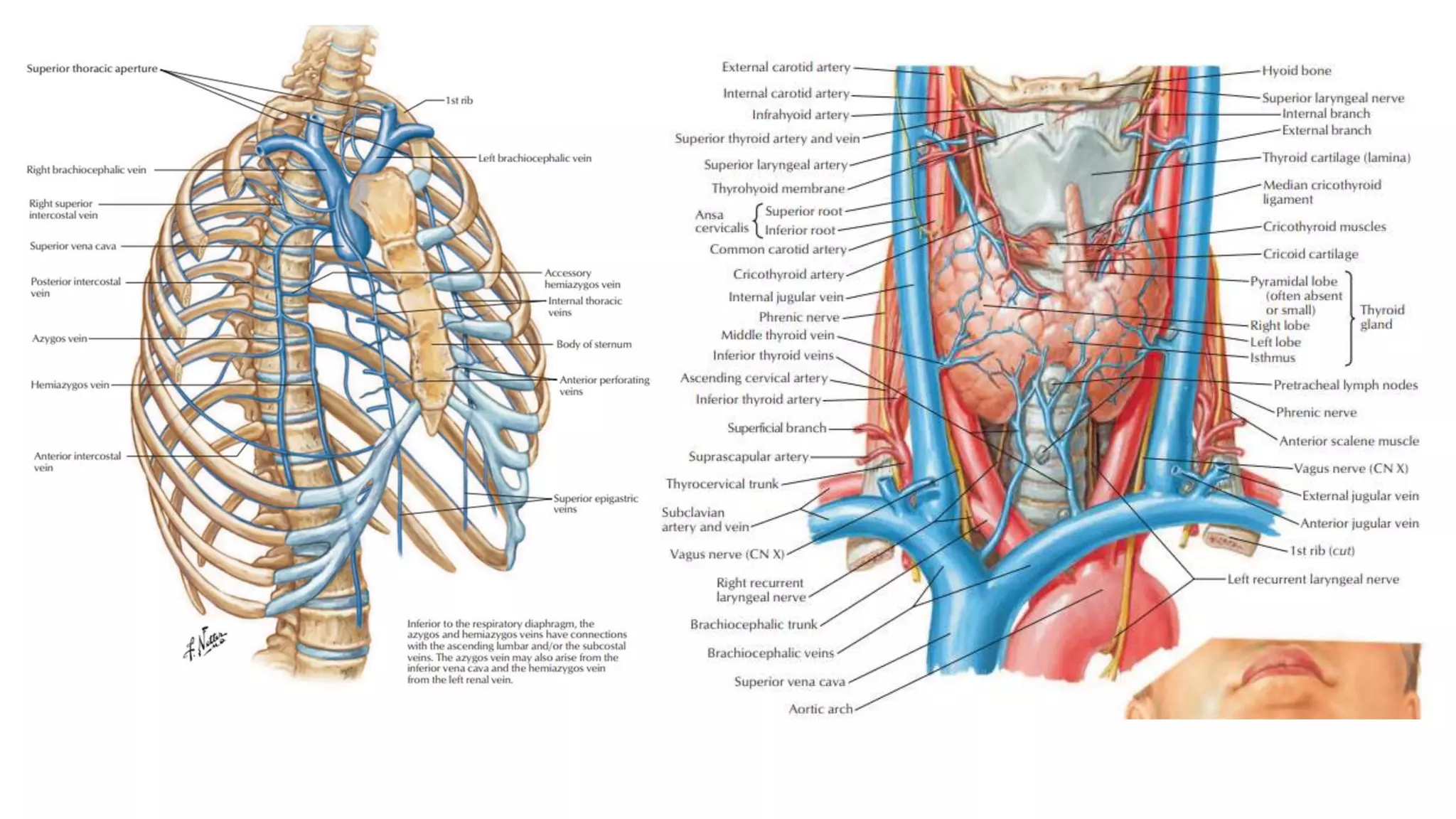 ANATOMY EMBRYOLOGY AND IMAGING OF SVC.pptx