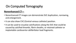 ANATOMY EMBRYOLOGY AND IMAGING OF SVC.pptx