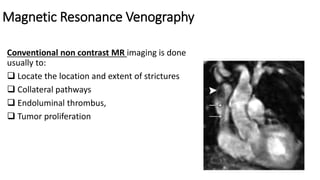 ANATOMY EMBRYOLOGY AND IMAGING OF SVC.pptx