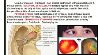Anatomy & embryology of external & middle ear | PPT