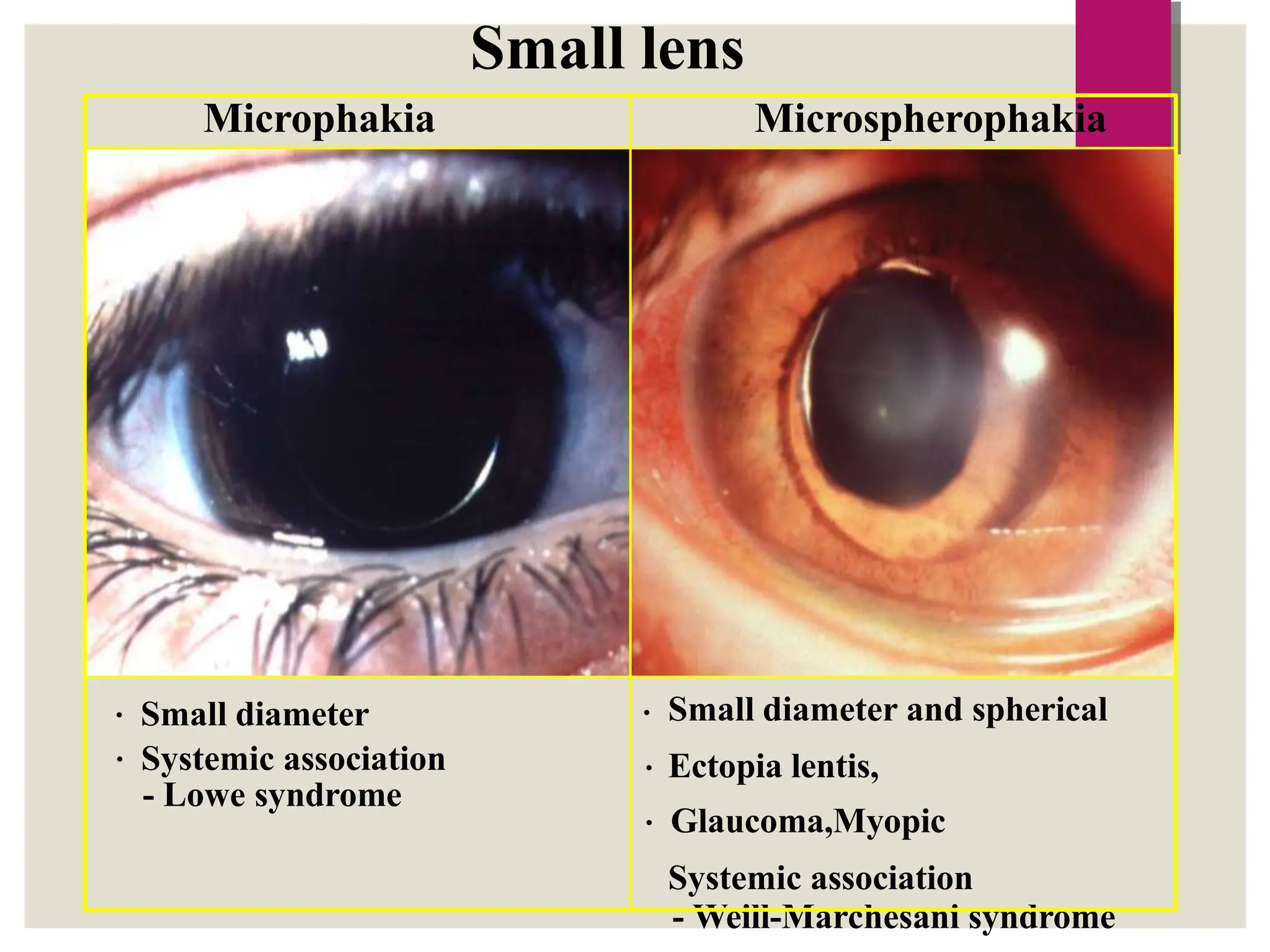 ANATOMY & EMBRYOLOGY OF LENS- Dr. Anuj Pawar.pptx