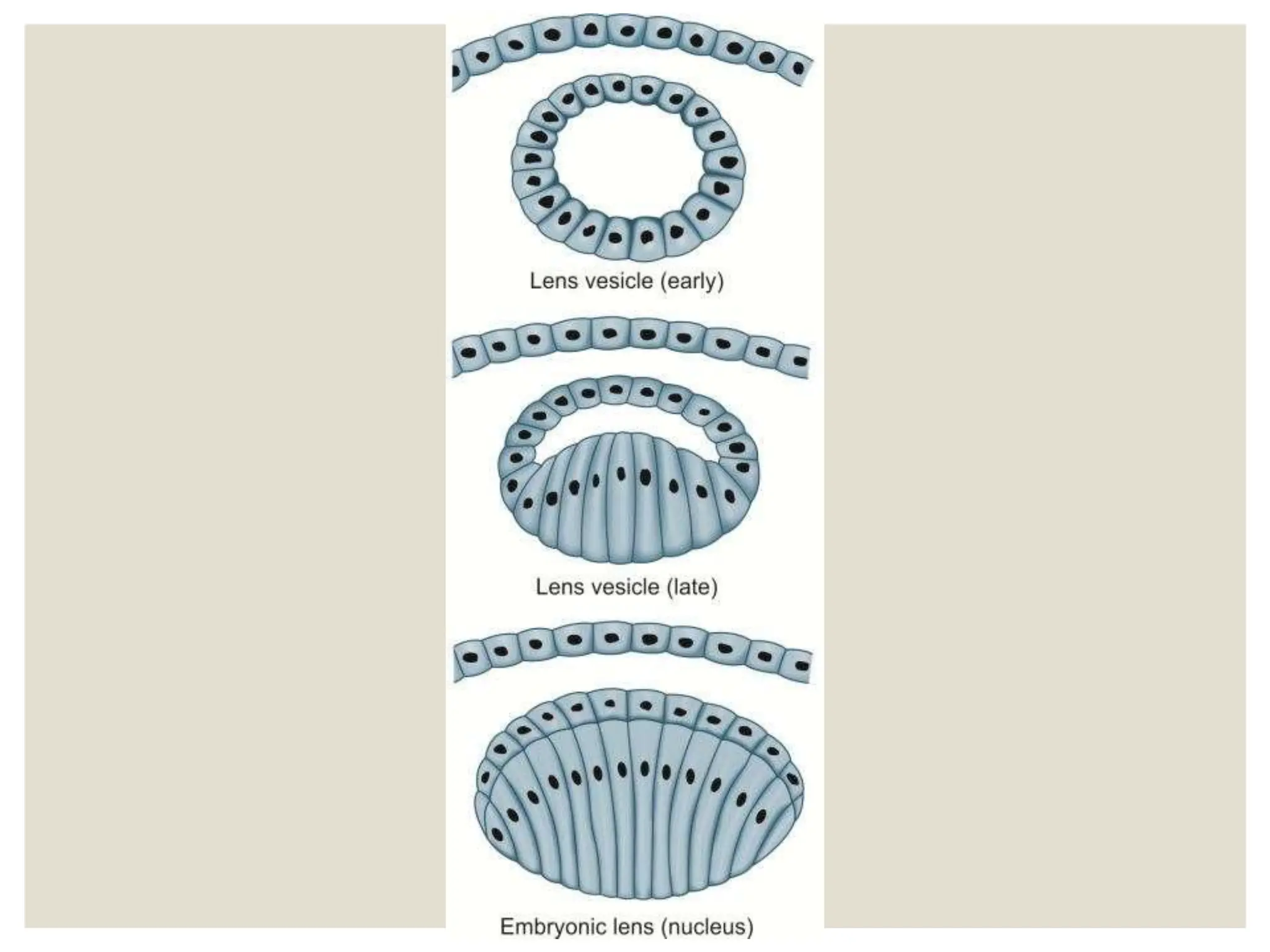 ANATOMY & EMBRYOLOGY OF LENS- Dr. Anuj Pawar.pptx