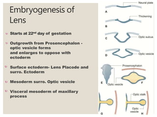 ANATOMY & EMBRYOLOGY OF LENS- Dr. Anuj Pawar.pptx