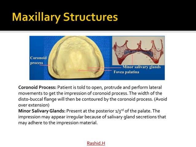 Anatomy for Complete and Partial Dentures (1).pptx