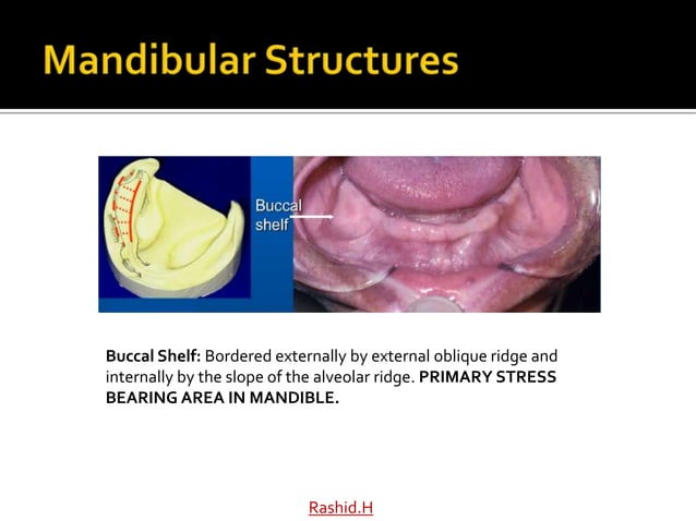 Anatomy for Complete and Partial Dentures (1).pptx
