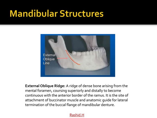 Anatomy for Complete and Partial Dentures (1).pptx