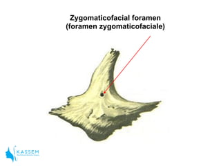 Zygomaticofacial And Zygomaticotemporal Foramen