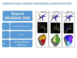 Anatomical liver resection | PPTX