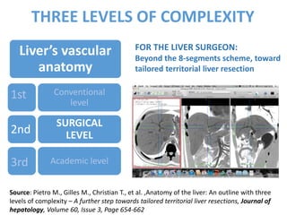 Anatomical liver resection | PPTX