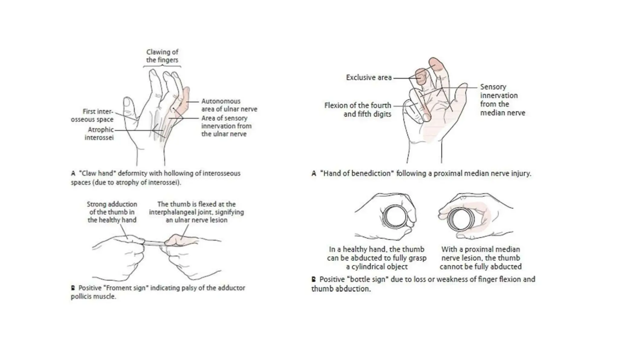 Gross anatomy of the hand with diagrams.pptx | Death, Injury, or ...