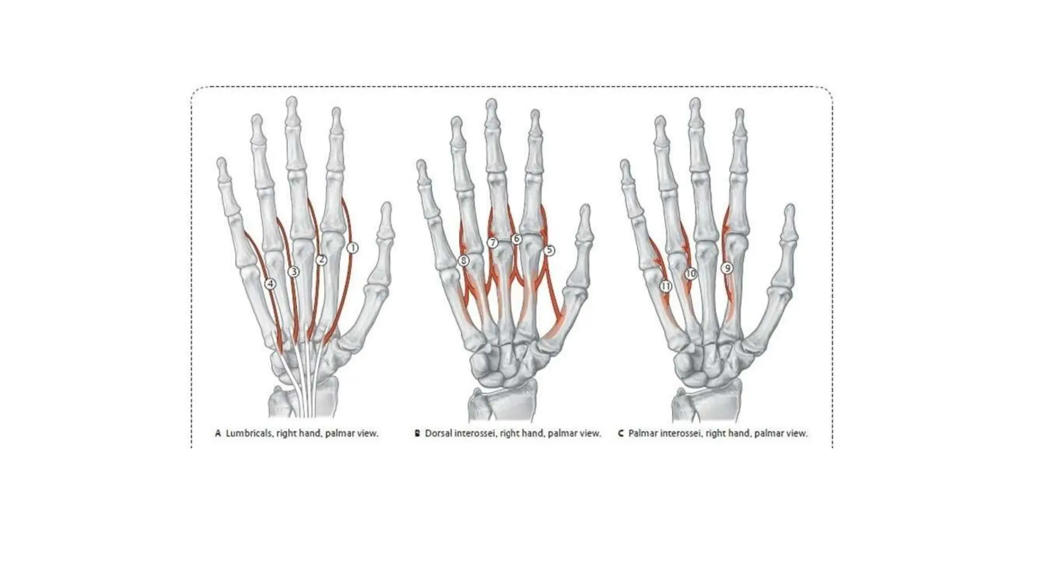 Gross anatomy of the hand with diagrams.pptx | Death, Injury, or ...