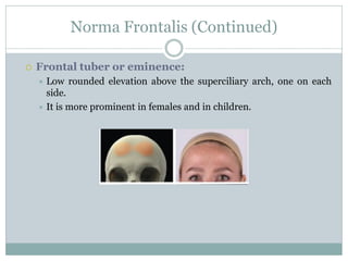 Anatomy head and neck(norma frontalis) | PDF