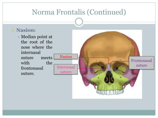 Frontonasal Suture