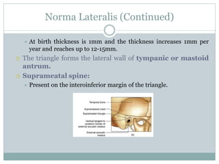 Anatomy head and neck(norma lateralis) | PDF