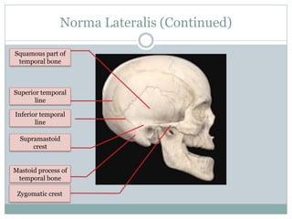 Anatomy head and neck(norma lateralis) | PDF