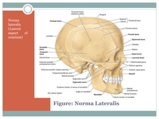 Anatomy head and neck(norma lateralis) | PPT
