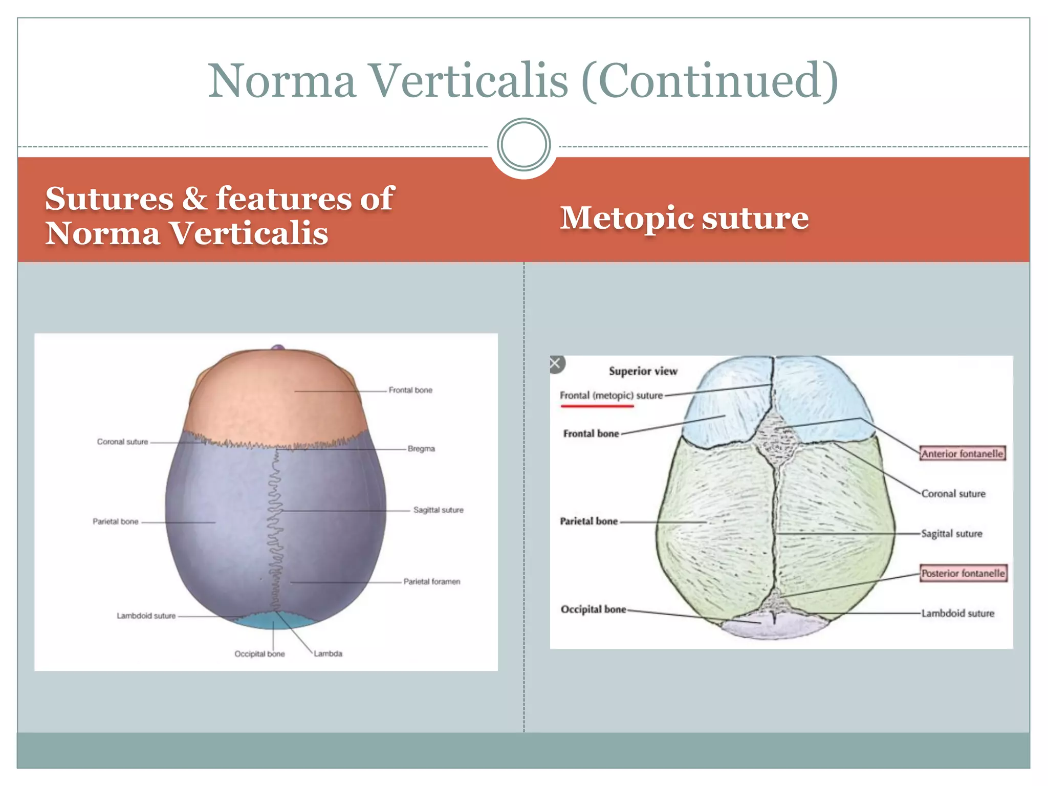 Anatomy head and neck (norma verticalis) | PDF