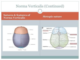Anatomy head and neck (norma verticalis) | PDF