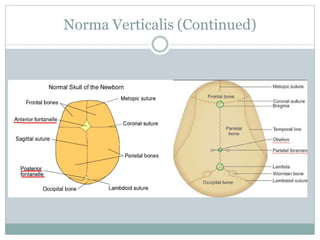 Anatomy head and neck (norma verticalis) | PDF
