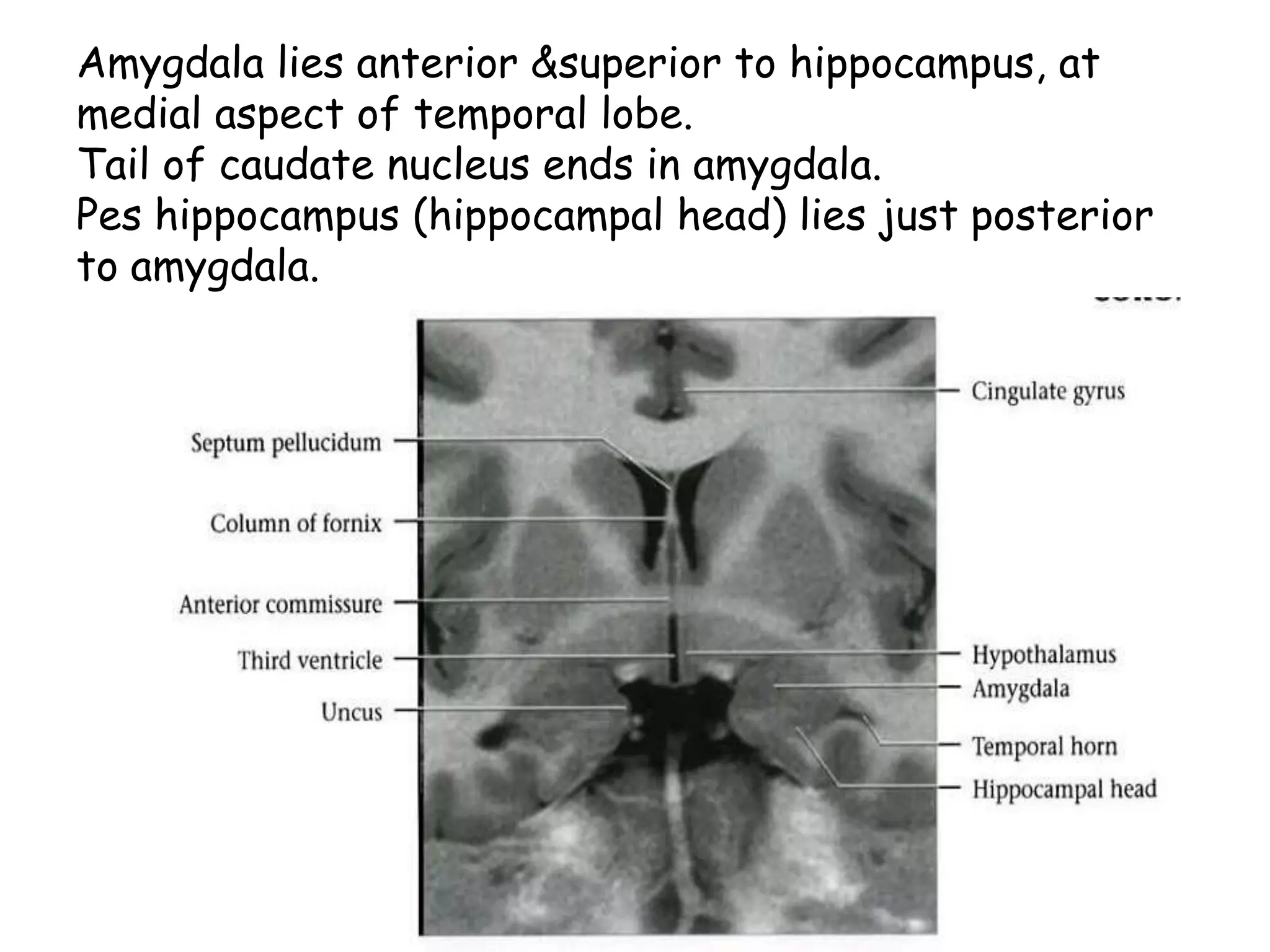 Anatomy of hippocampus ( radiology ) | PPTX