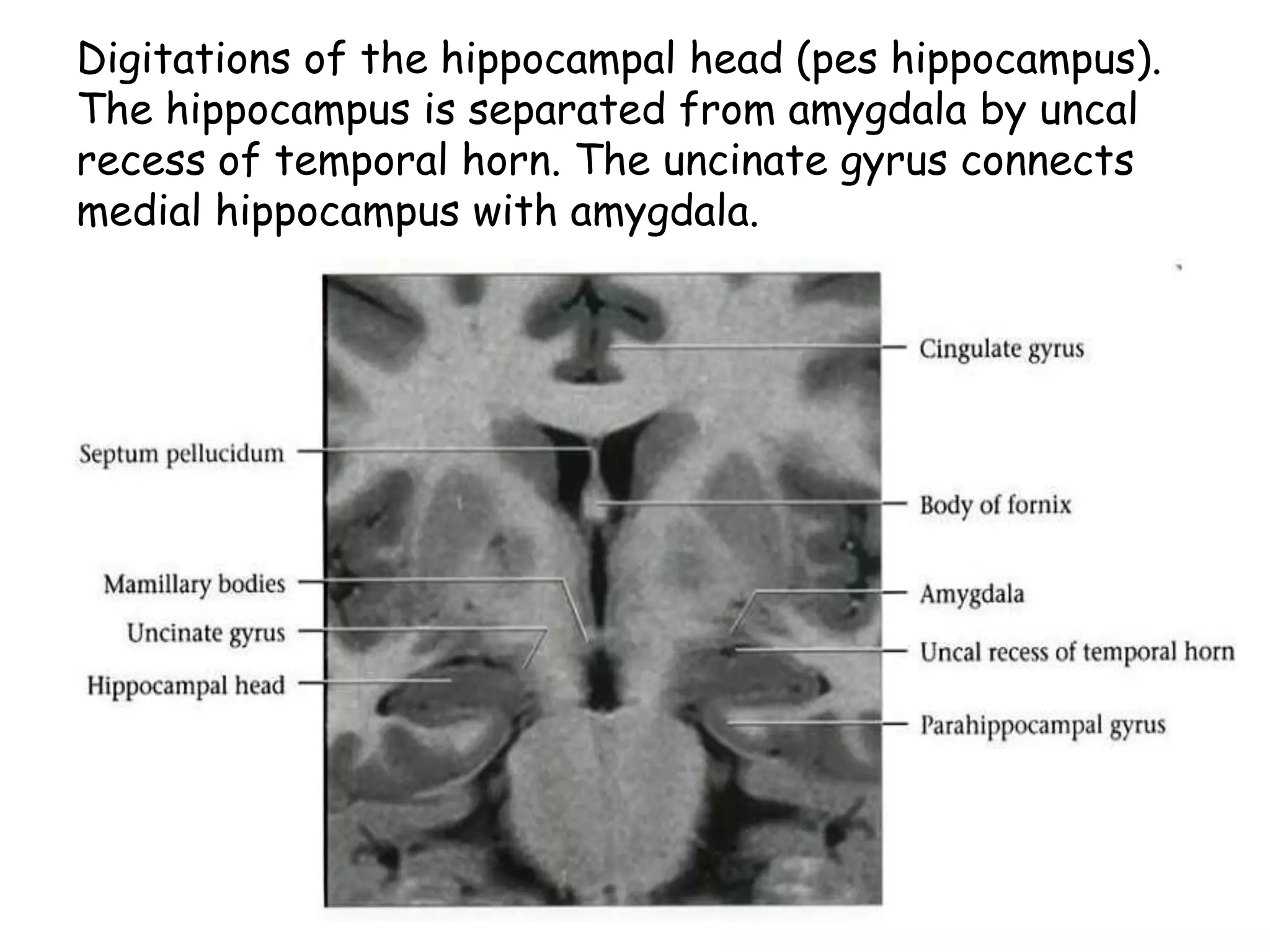 Anatomy of hippocampus ( radiology ) | PPTX