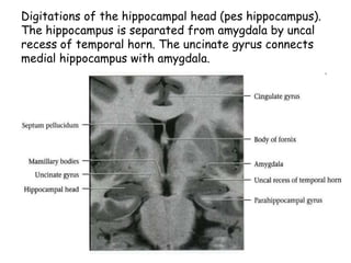 Anatomy of hippocampus ( radiology ) | PPTX