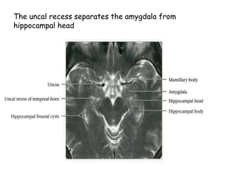 Hippocampus Anatomy Mri