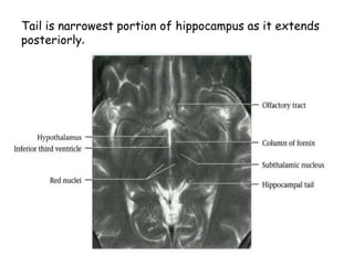 Hippocampus Anatomy Mri