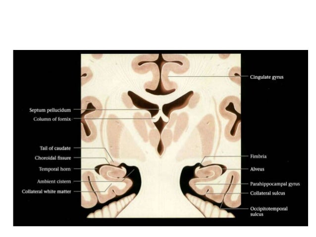 Anatomy of hippocampus ( radiology )
