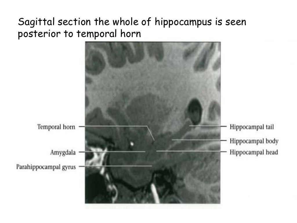 Anatomy of hippocampus ( radiology )