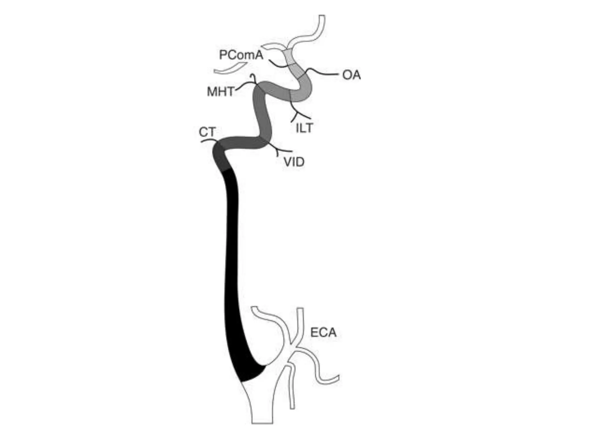 Interventional Neuroradiology: Anatomy of the internal carotid artery ...
