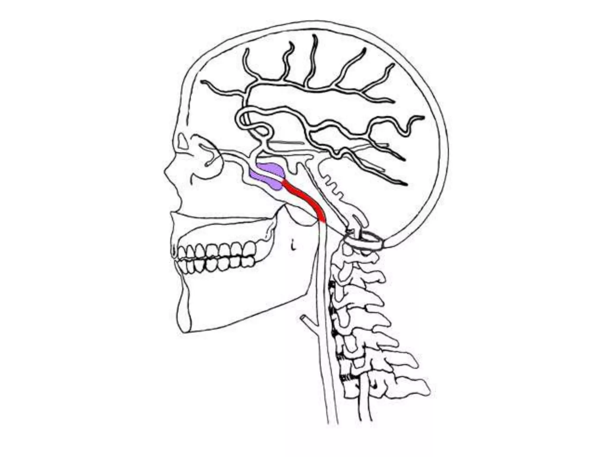 Interventional Neuroradiology: Anatomy of the internal carotid artery ...