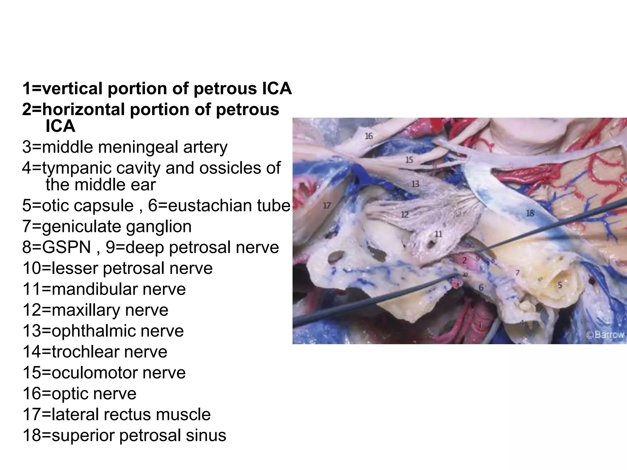 Interventional Neuroradiology: Anatomy of the internal carotid artery ...