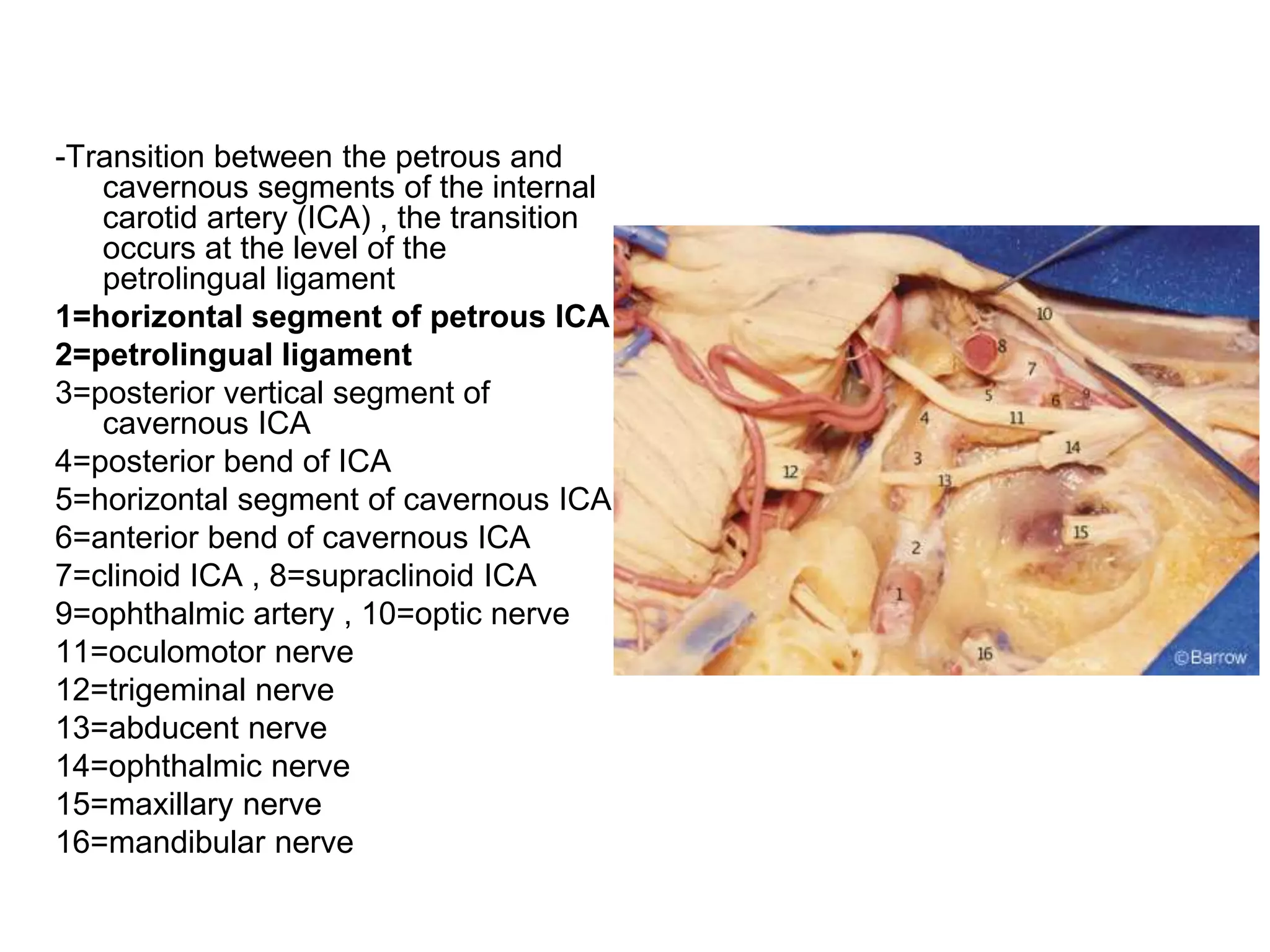 Interventional Neuroradiology: Anatomy of the internal carotid artery (ICA) | PPT