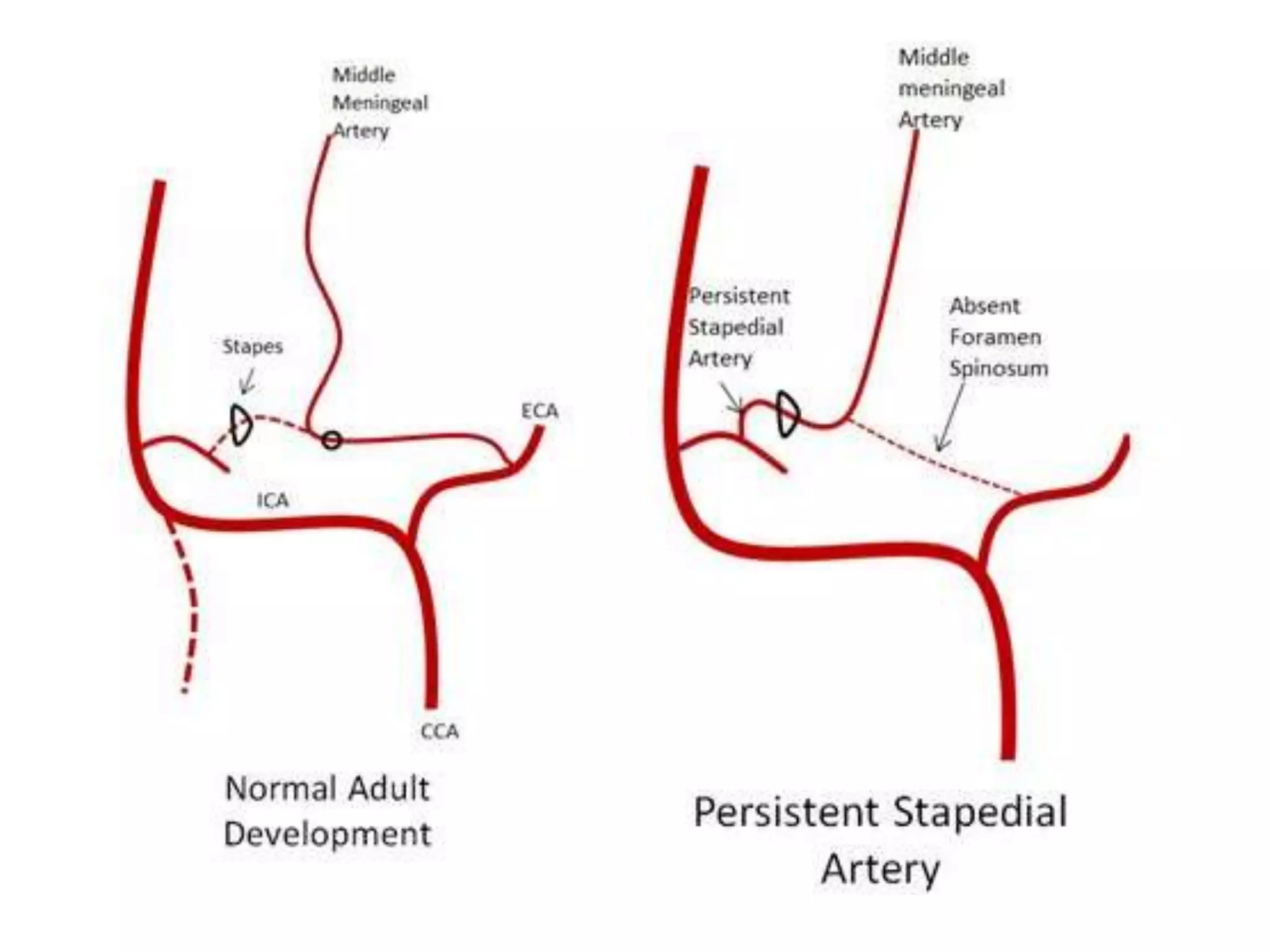 Interventional Neuroradiology: Anatomy of the internal carotid artery ...