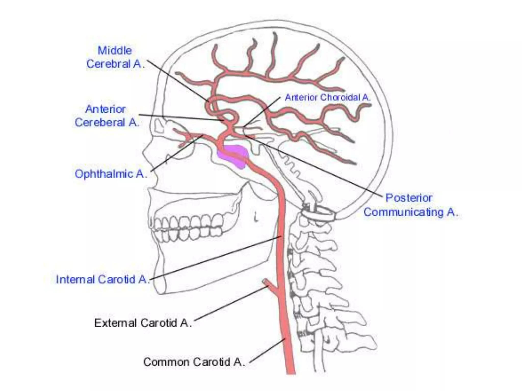 Interventional Neuroradiology: Anatomy of the internal carotid artery ...