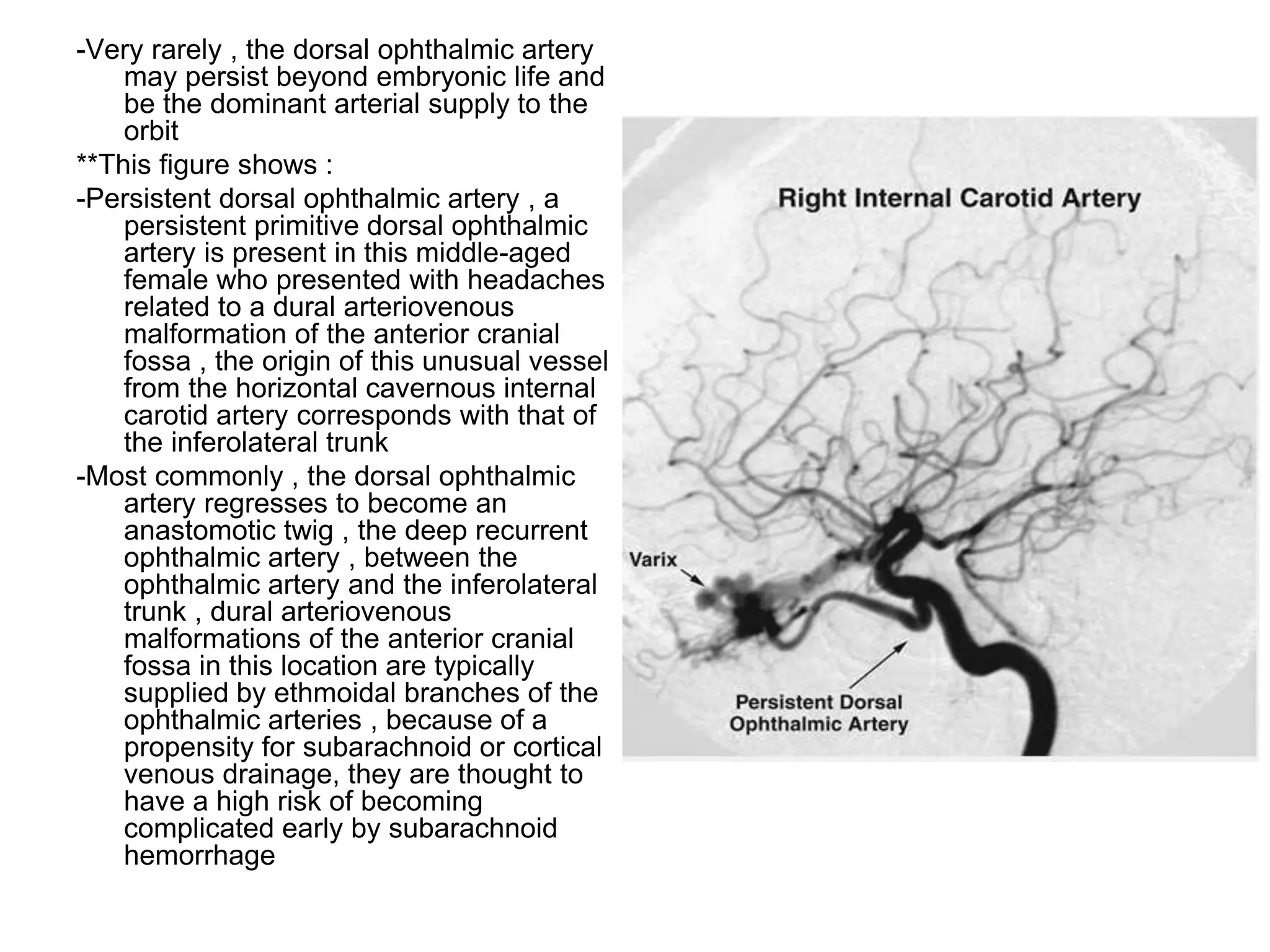 Interventional Neuroradiology: Anatomy of the internal carotid artery ...