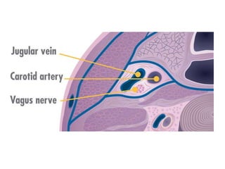 Interventional Neuroradiology: Anatomy of the internal carotid artery ...