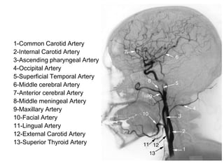 Interventional Neuroradiology: Anatomy of the internal carotid artery ...