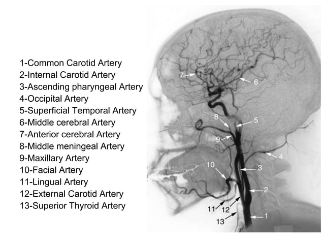 Interventional Neuroradiology: Anatomy of the internal carotid artery ...