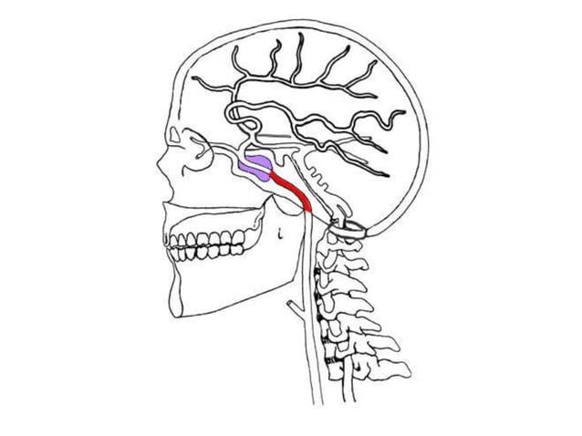 Interventional Neuroradiology: Anatomy of the internal carotid artery ...