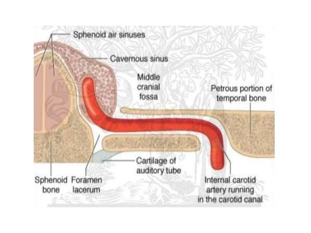 Interventional Neuroradiology: Anatomy of the internal carotid artery ...