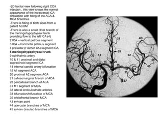 Interventional Neuroradiology: Anatomy of the internal carotid artery ...