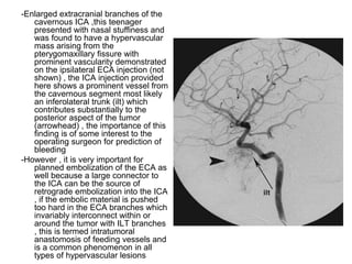 Interventional Neuroradiology: Anatomy of the internal carotid artery ...