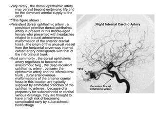 Interventional Neuroradiology: Anatomy of the internal carotid artery ...