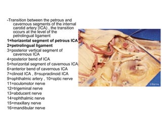 Interventional Neuroradiology: Anatomy of the internal carotid artery ...