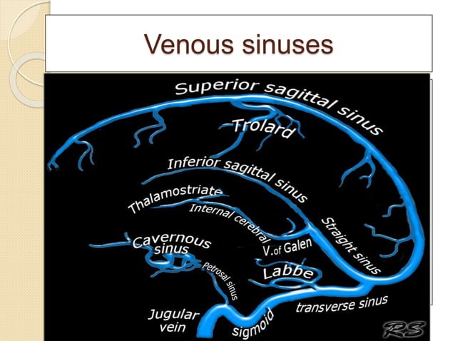 Anatomy icp dtt | PPTX