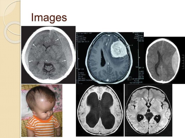 Anatomy icp dtt | PPTX
